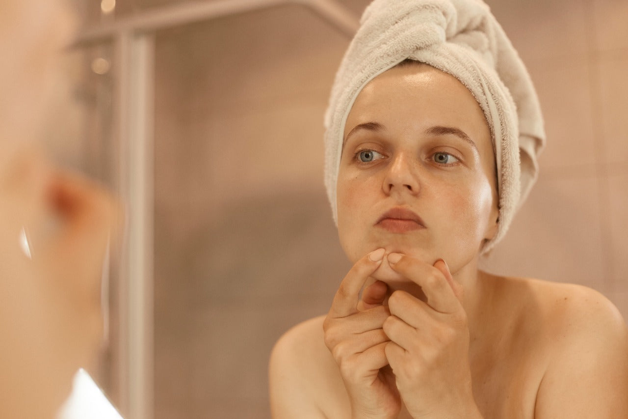 How To Manage White Spots On Face Mars By GHC how-to-manage-white-spots-on-face-mars-by-ghc