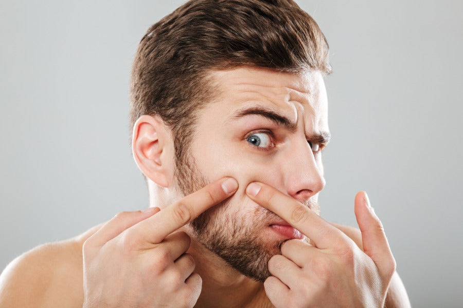 Quick Remedies for Adult Acne in Men – mars by GHC
