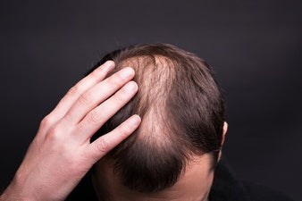 What is patchy hair loss: Causes and treatment – mars by GHC
